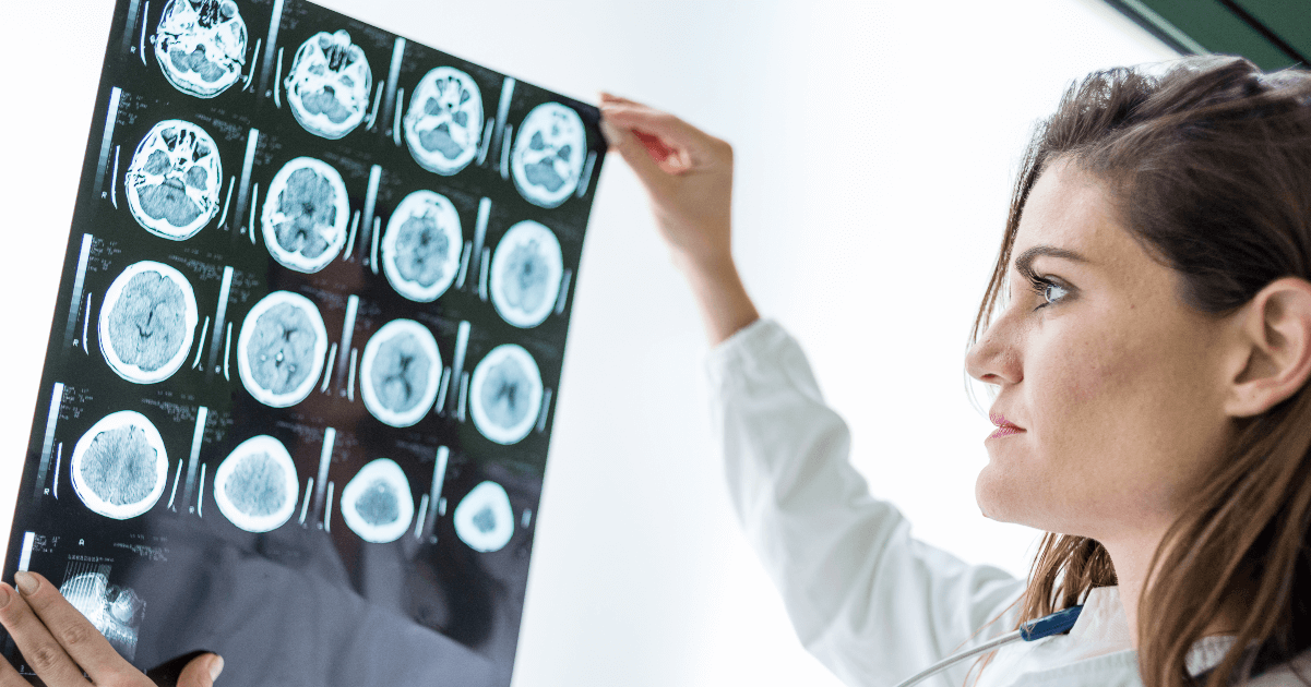 Traumatic Brain Injuries Often Caused by Car Crashes