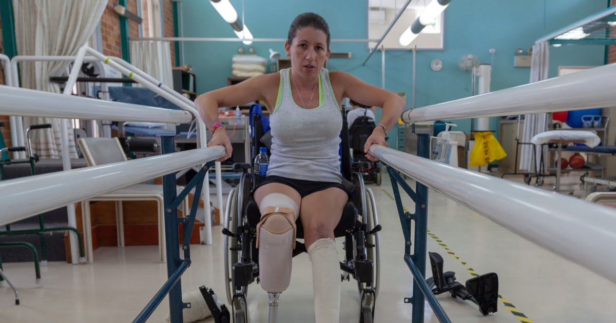 What if I Suffered an Amputation in a Harrisburg Car Crash?